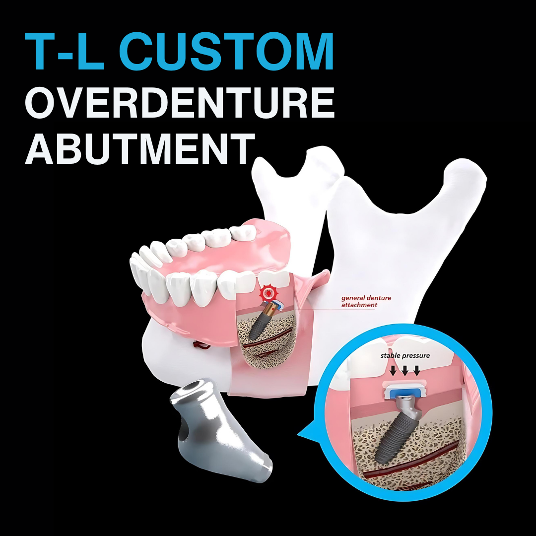 T-L Custom Overdenture Abutment | Precision Fit for Enhanced Denture ...