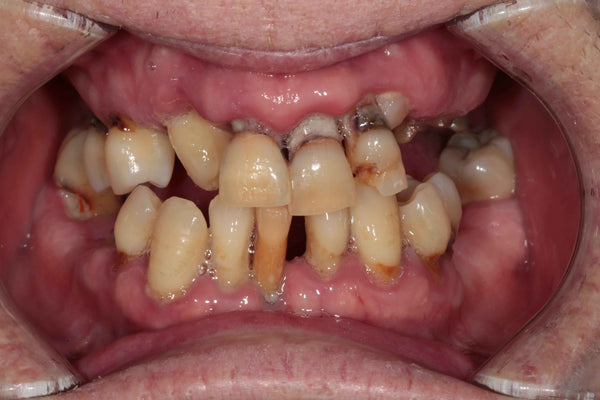 Introducing ioConnect – Photogrammetry with Your Intra Oral Scanner ...